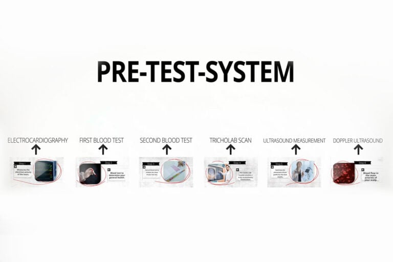 Elithair Pre-Test System - optimal hair transplantation | Elithair