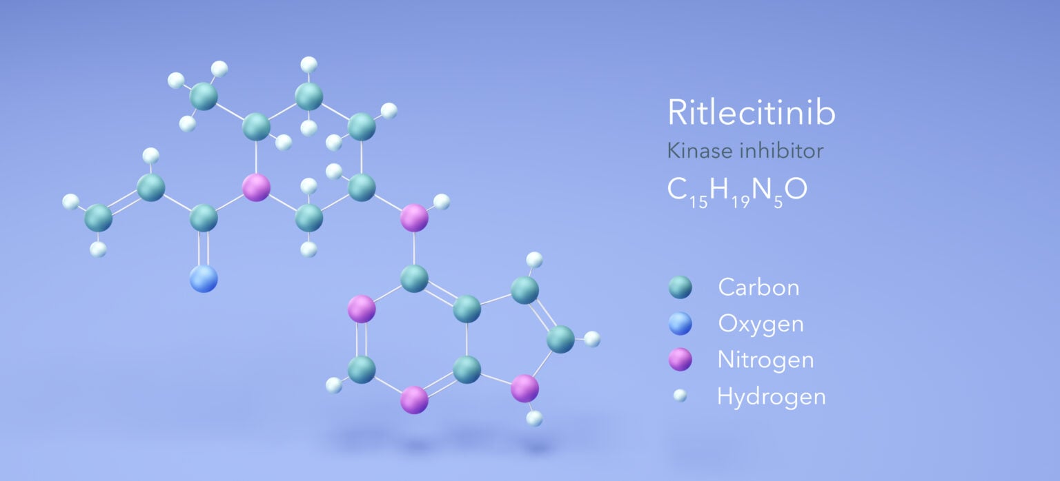 Litfulo Explained: The First NHS-Approved Drug for Alopecia Areata